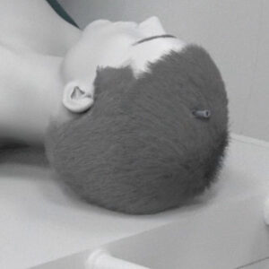 The NeuroBlate® Laser Ablation System | Monteris