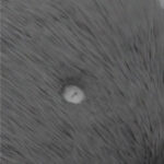 The NeuroBlate® Laser Ablation System | Monteris